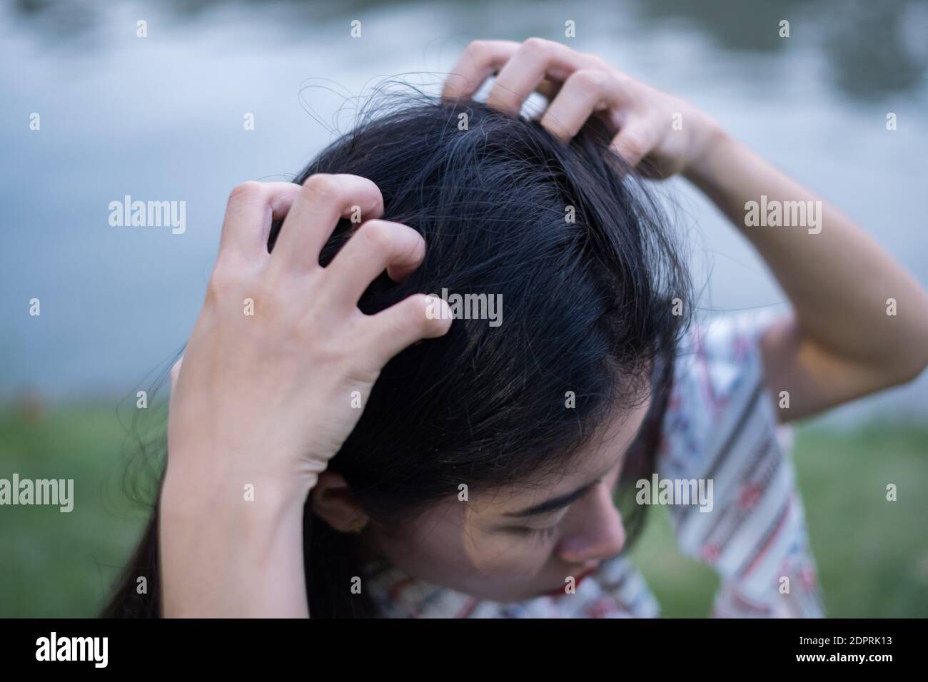 Scaly Skin Woman High Resolution Stock Photography and Images - Alamy
