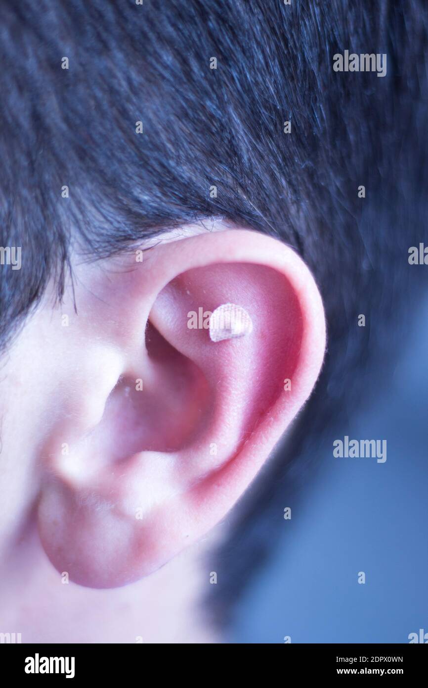 Bandage ear hi-res stock photography and images - Alamy