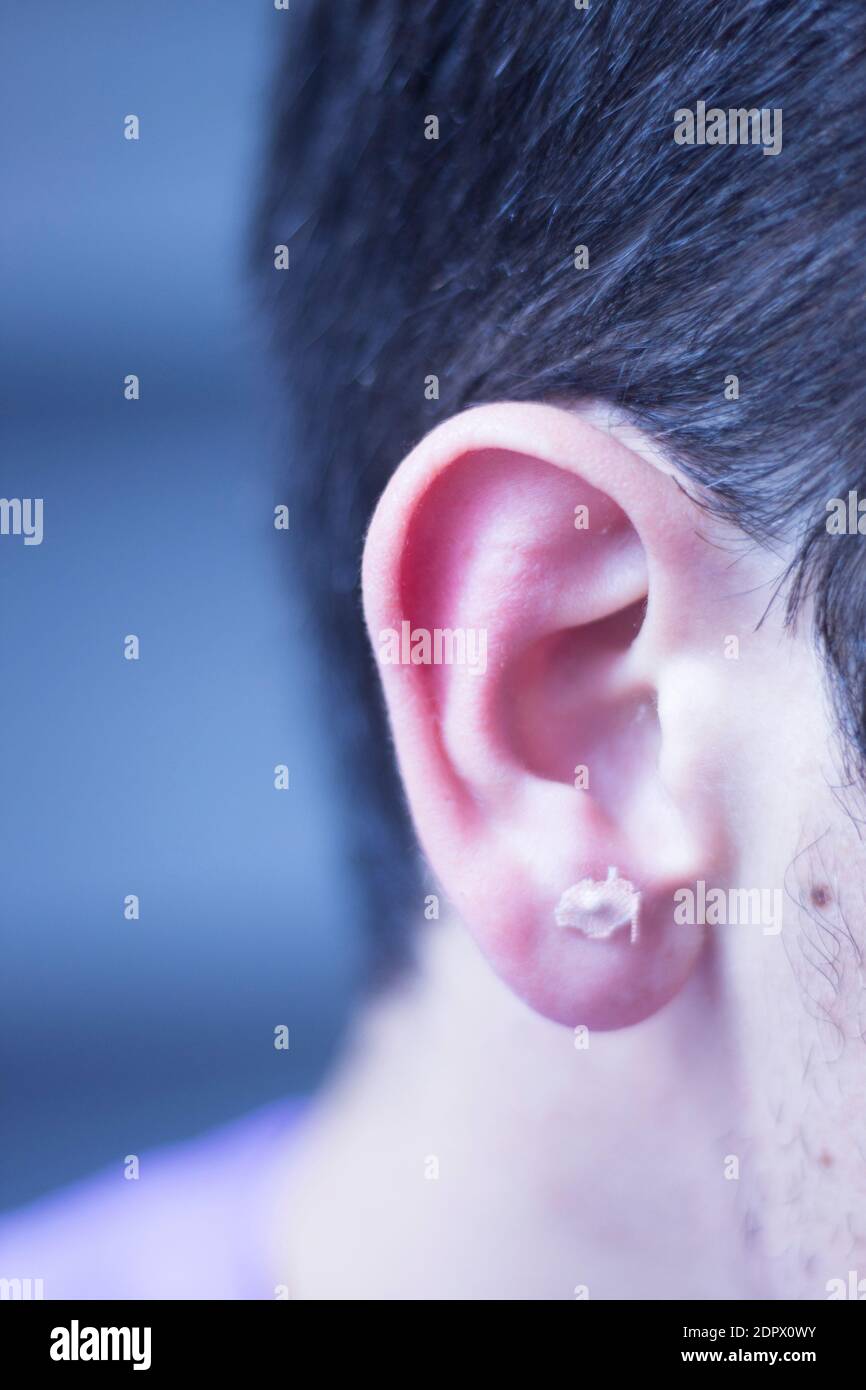 Bandage ear hi-res stock photography and images - Alamy