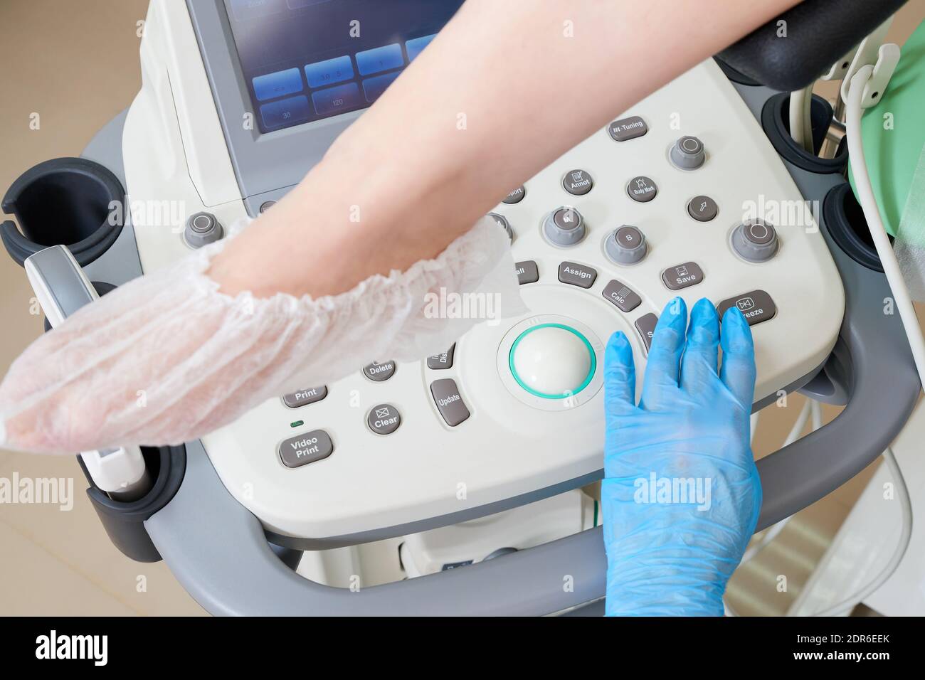 Woman gynecological exam hi-res stock photography and images - Alamy
