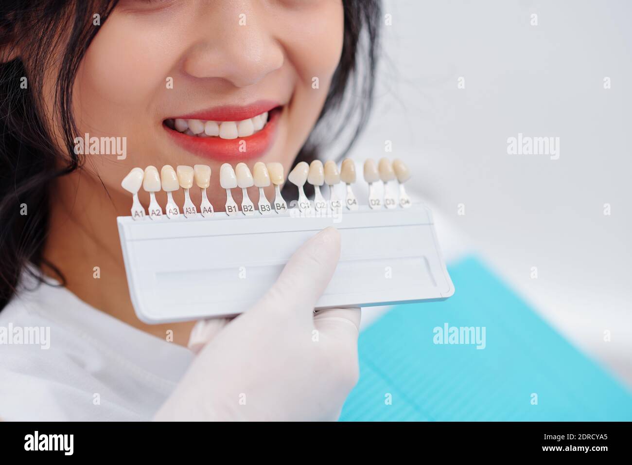 Dentist using teeth color palette Stock Photo - Alamy