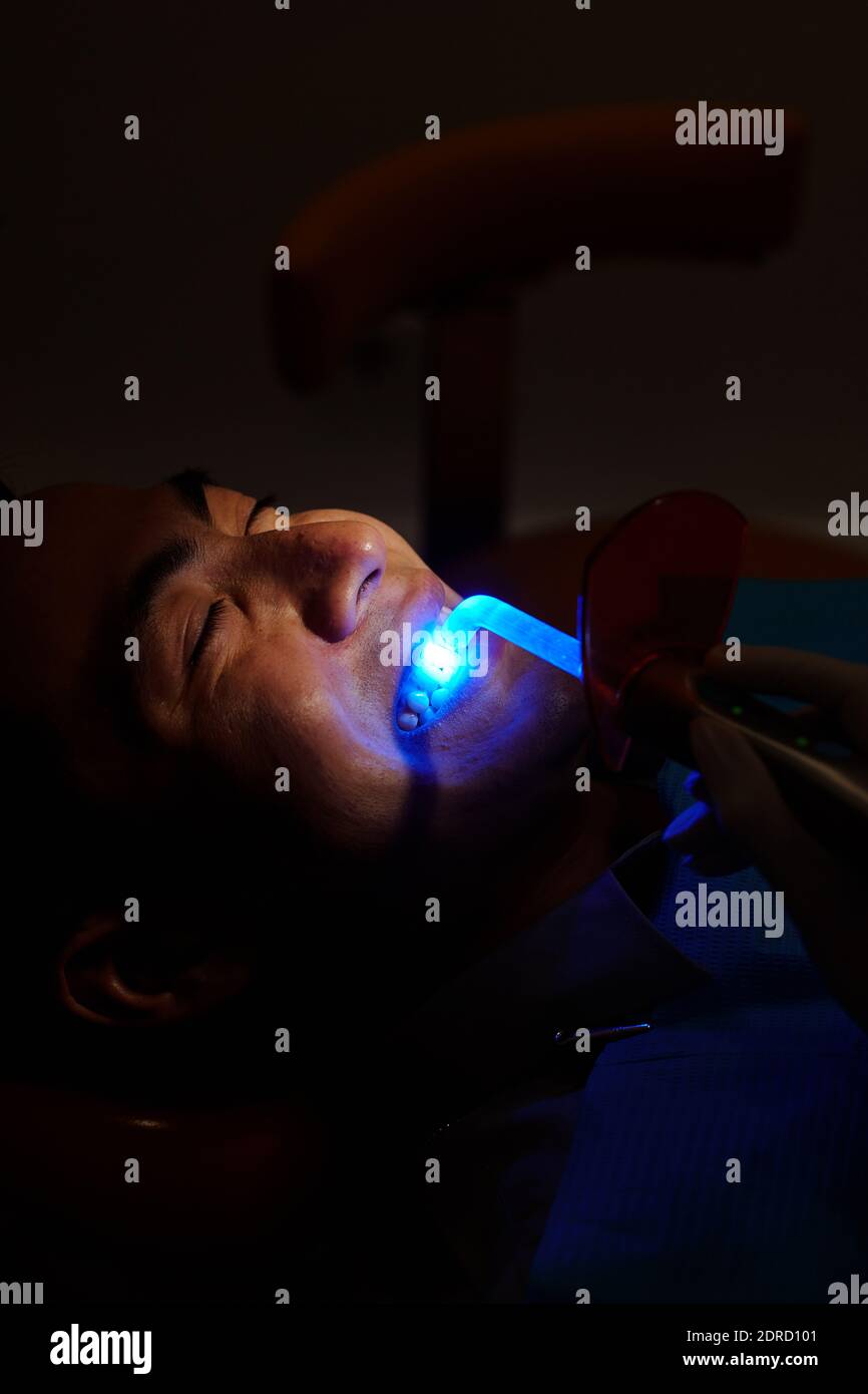 Composite filling hi-res stock photography and images - Alamy