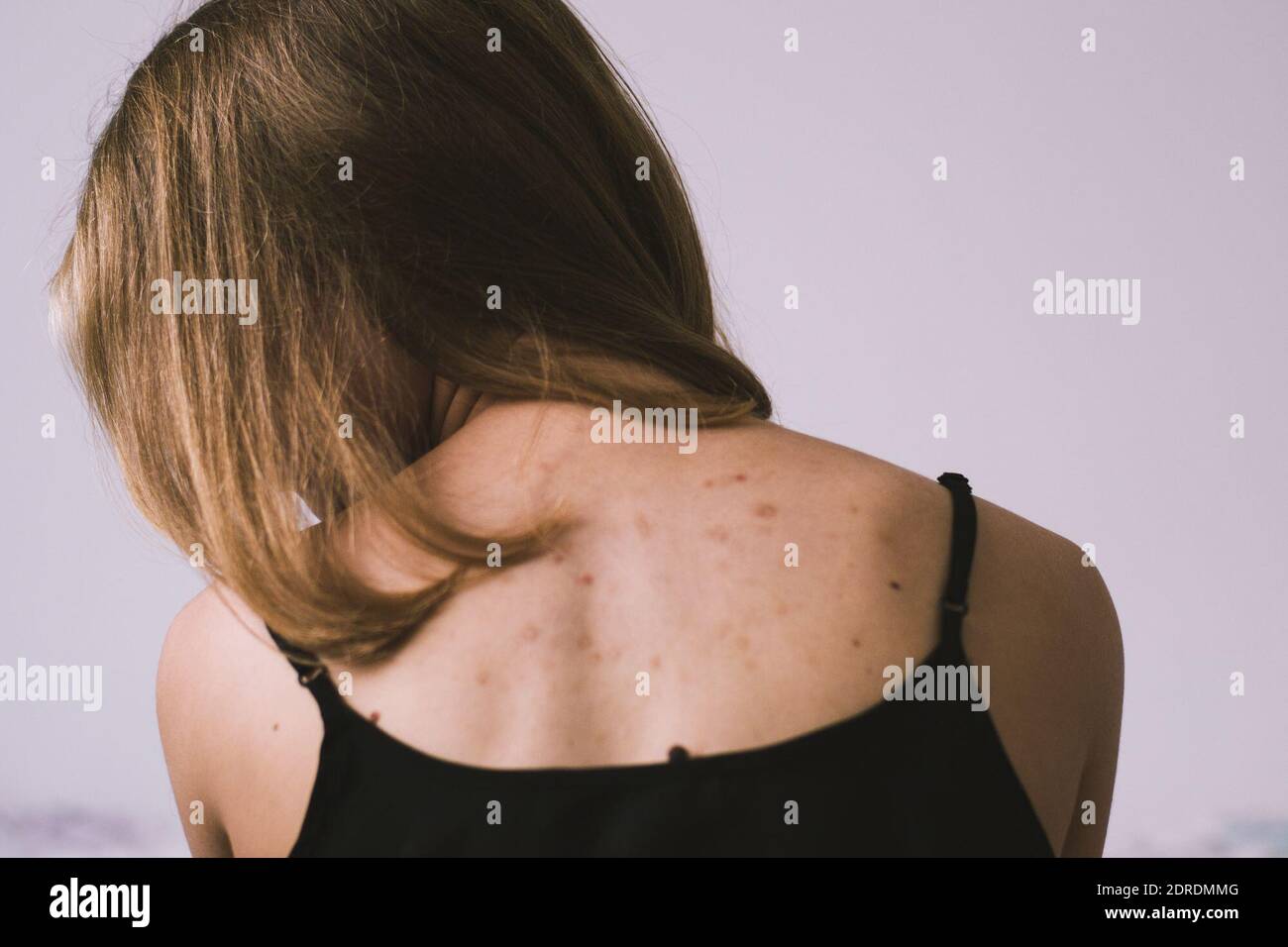 Spots on the back hi-res stock photography and images - Alamy