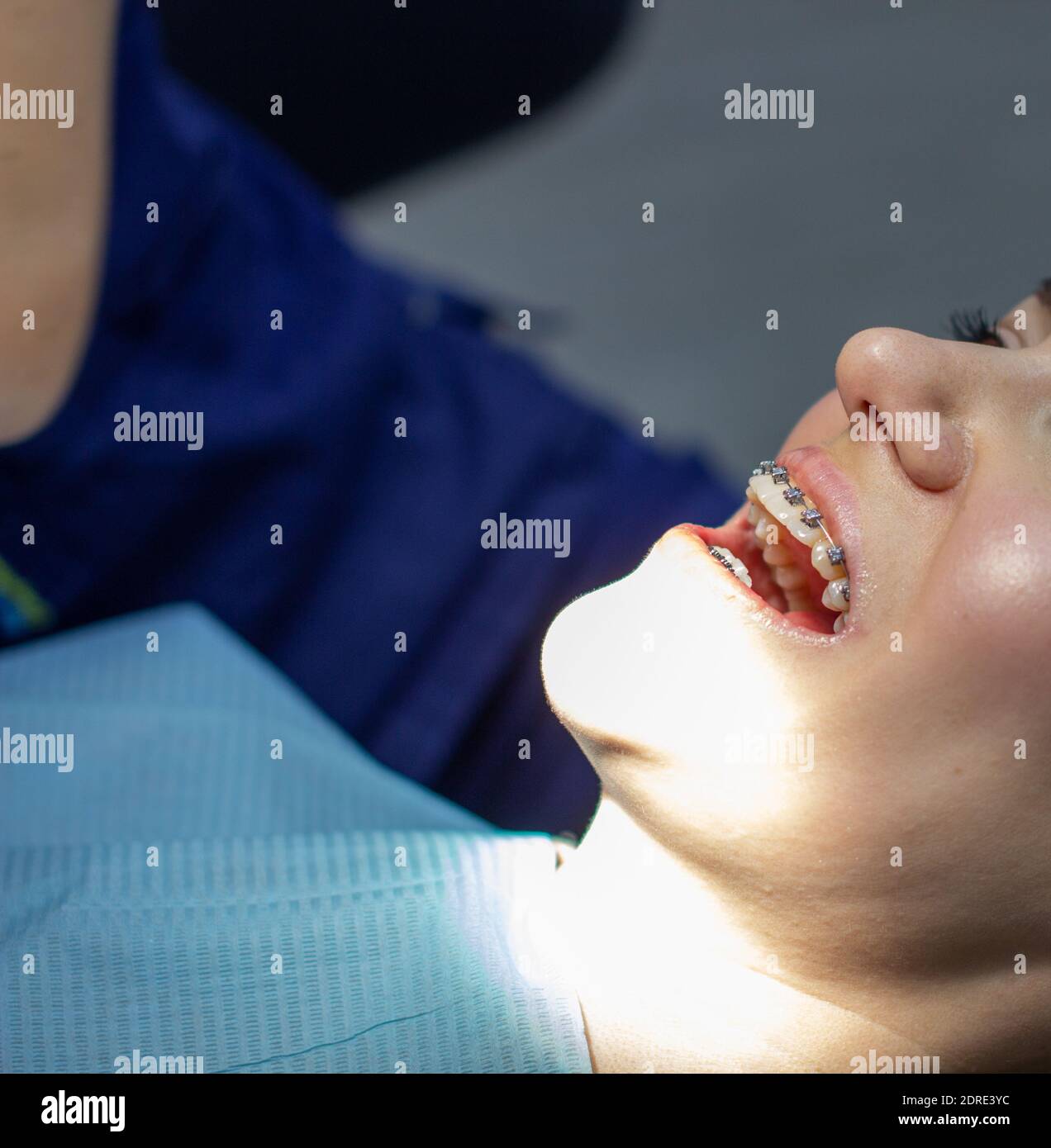 A woman with braces on her teeth visits an orthodontist, in a dental ...