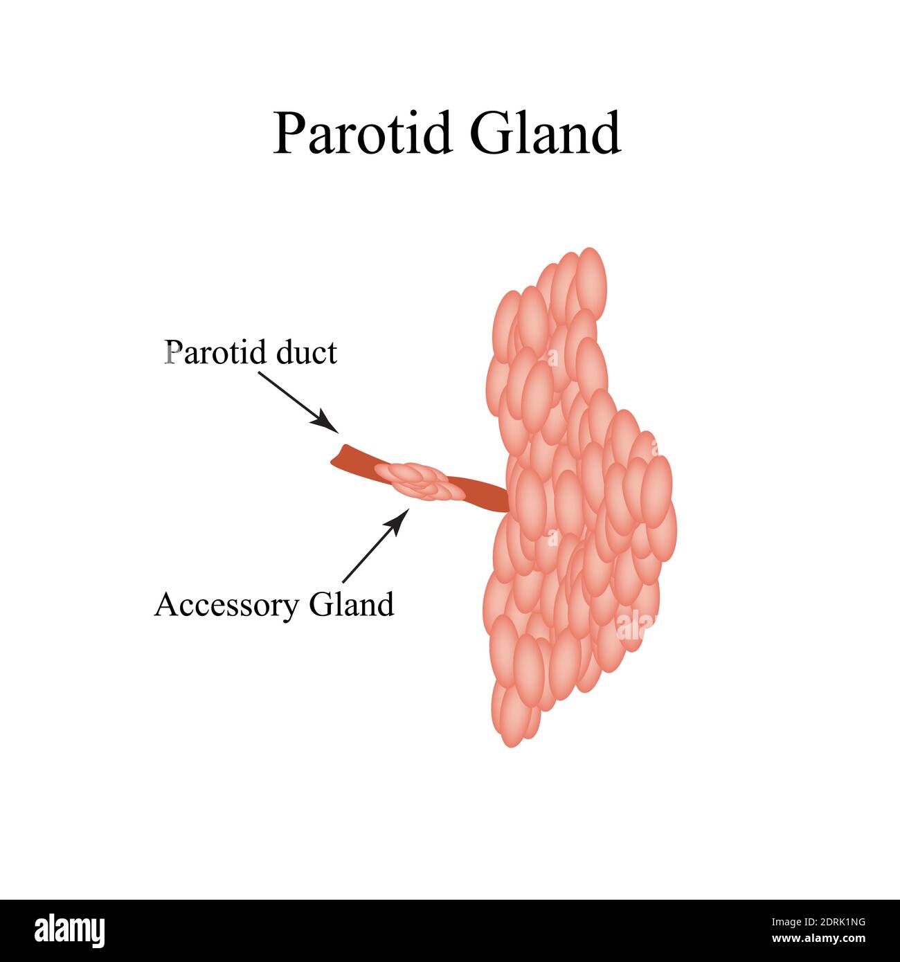 Swollen Accessory Parotid Gland