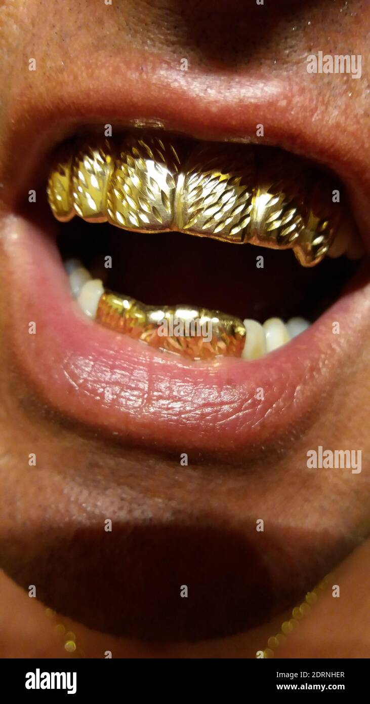 Gold tooth hi-res stock photography and images - Alamy