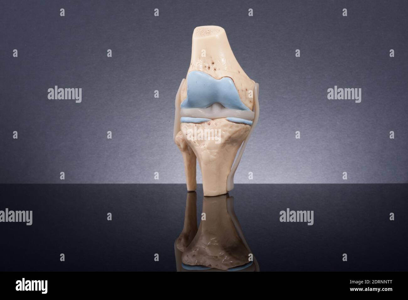 Artificial bone hi-res stock photography and images - Alamy