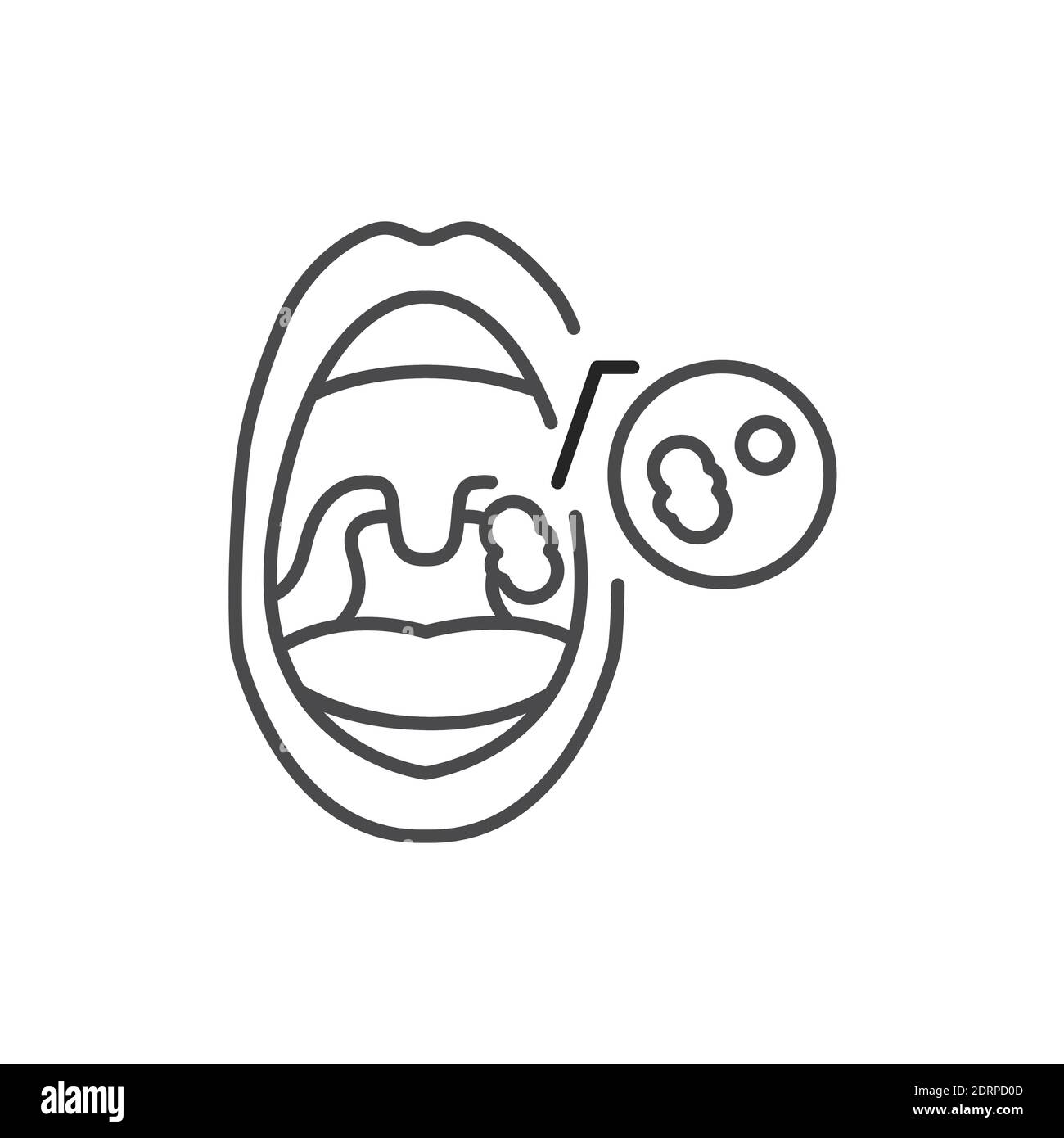 Adenoids Stock Vector Images - Alamy