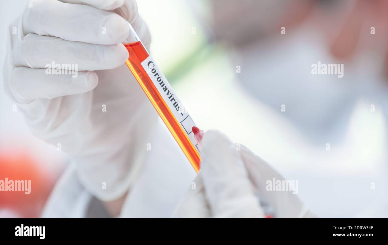 background image marking the tube with the tested test Stock Photo - Alamy