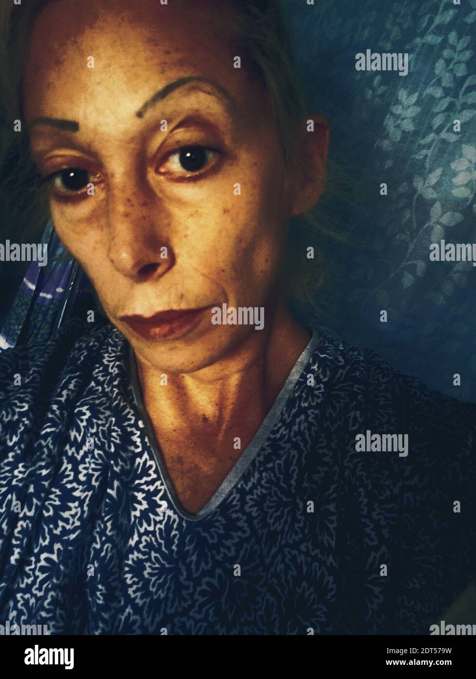 Trauma women hi-res stock photography and images - Alamy