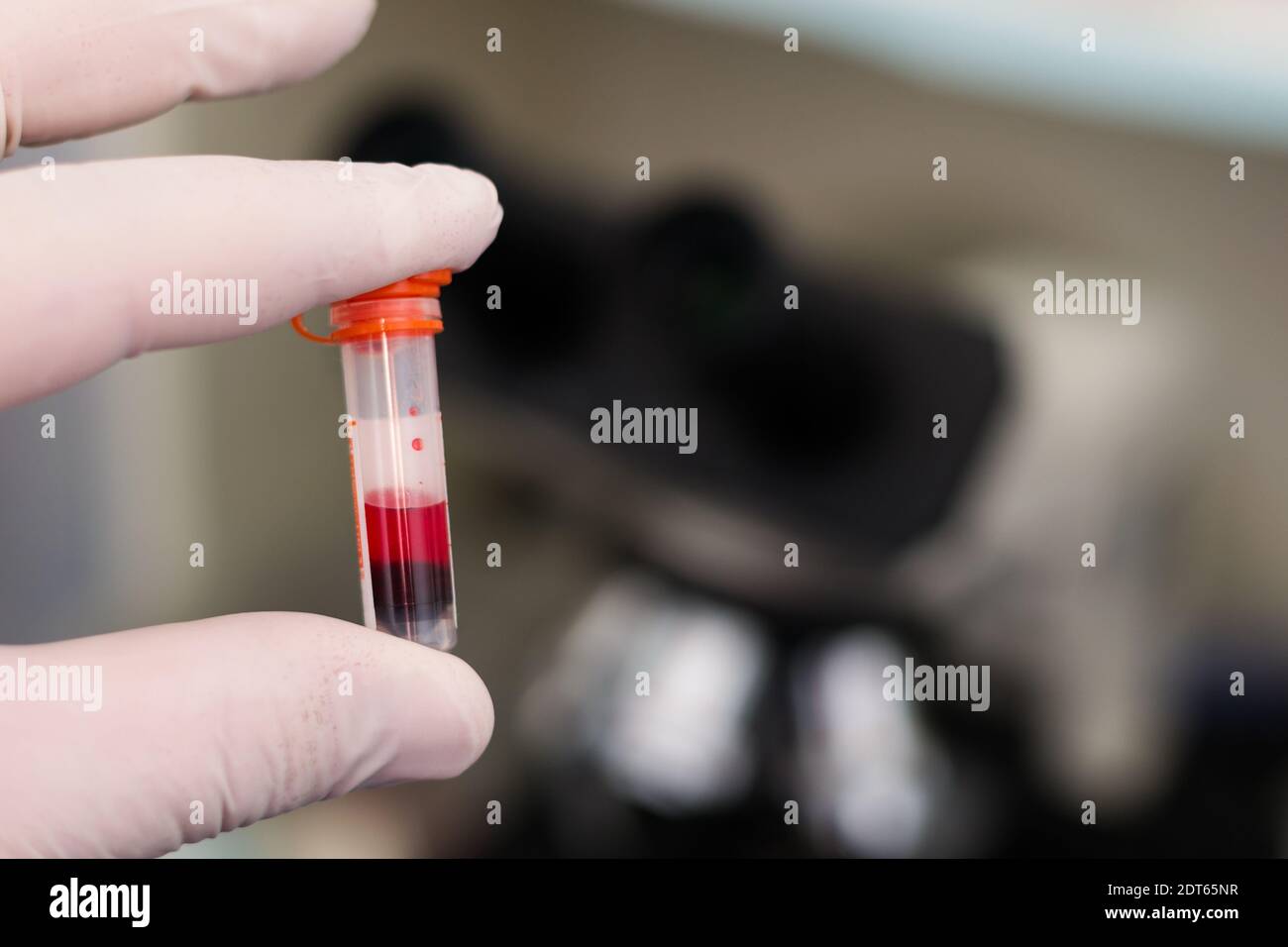 Container human blood hi-res stock photography and images - Alamy