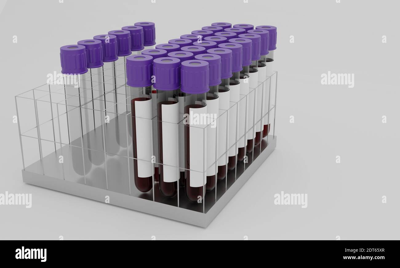Plasma samples hi-res stock photography and images - Alamy