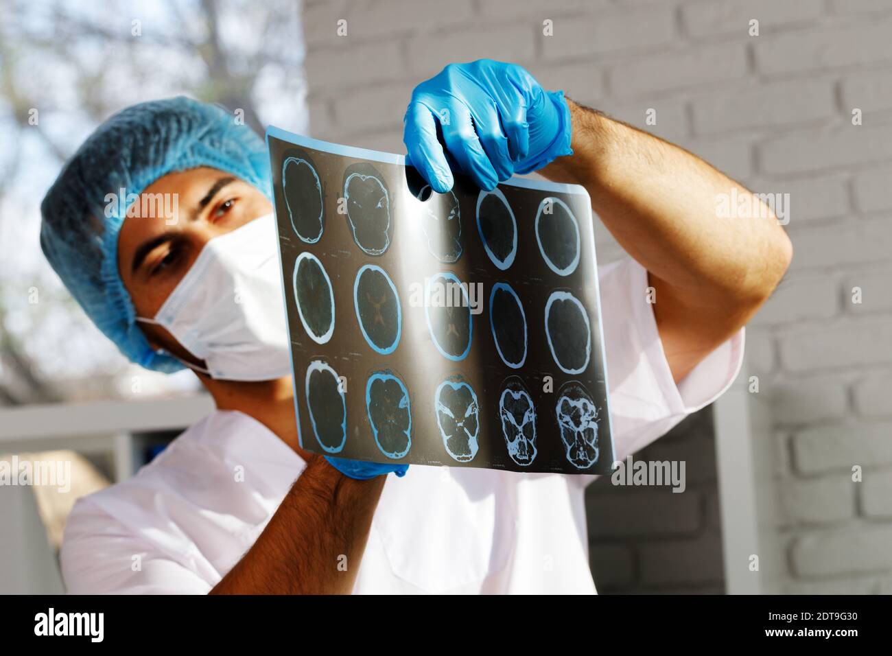 Mri scans of brain hi-res stock photography and images - Alamy