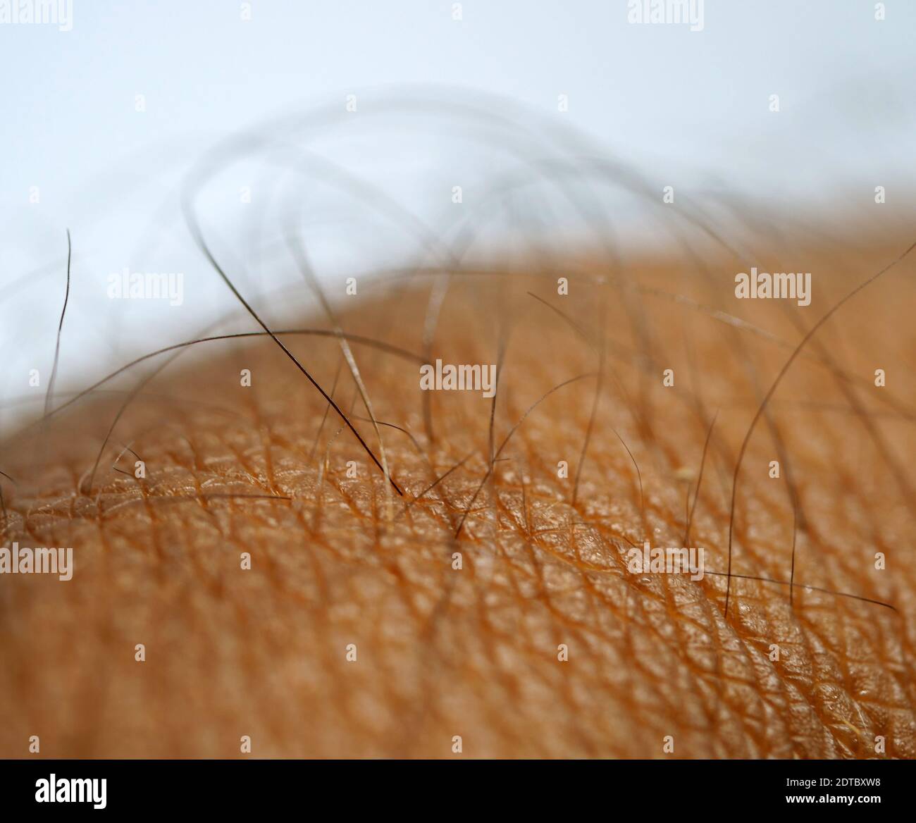 Human skin macro hair hi-res stock photography and images - Alamy