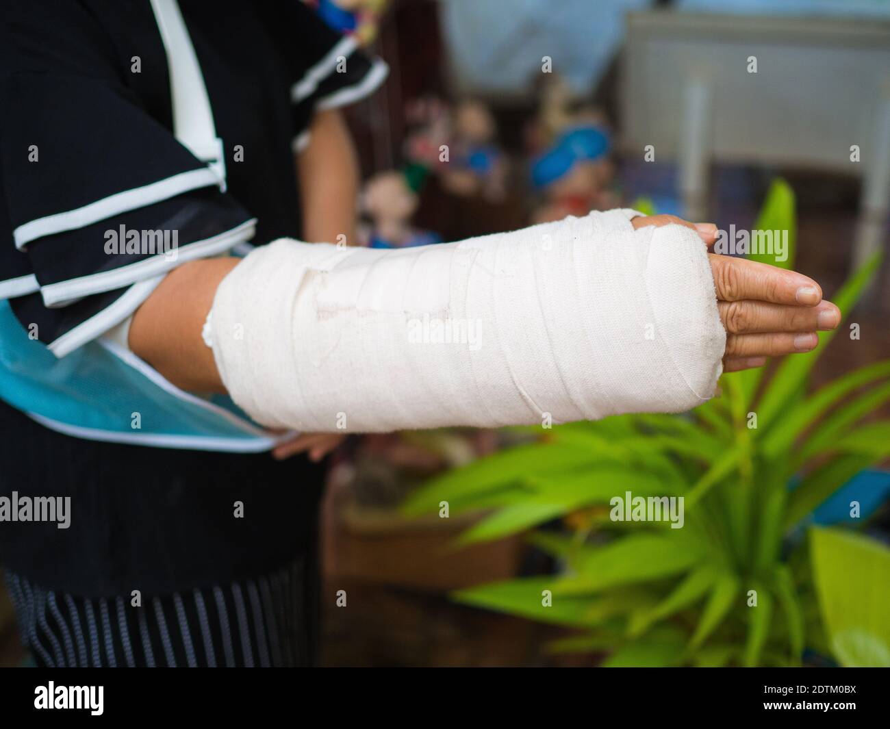 Finger Accidents High Resolution Stock Photography and Images - Alamy