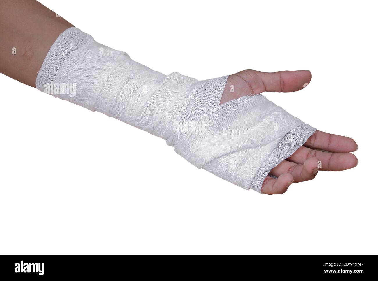 Human body fractured hi-res stock photography and images - Alamy