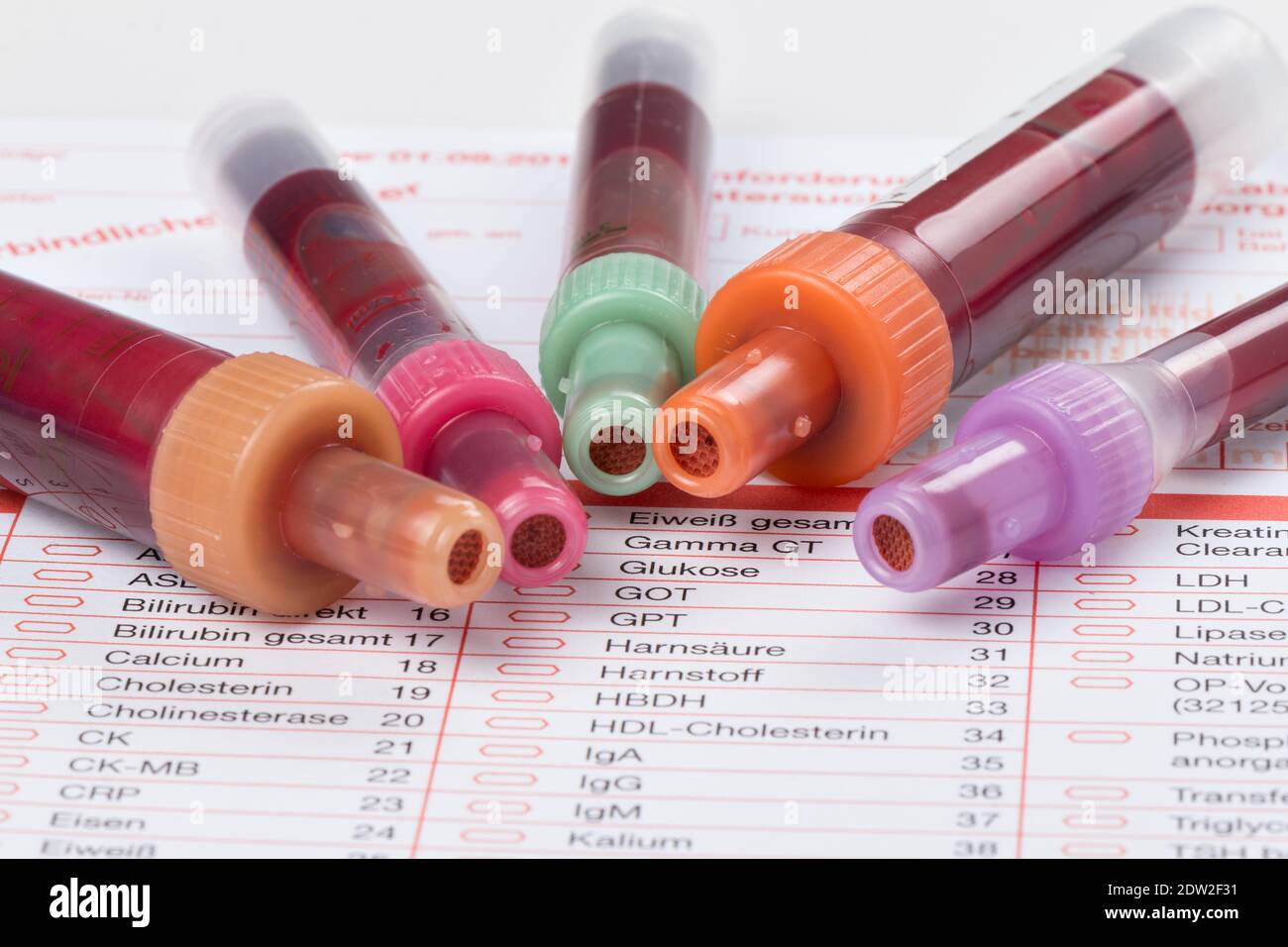 Medical tests form hi-res stock photography and images - Alamy