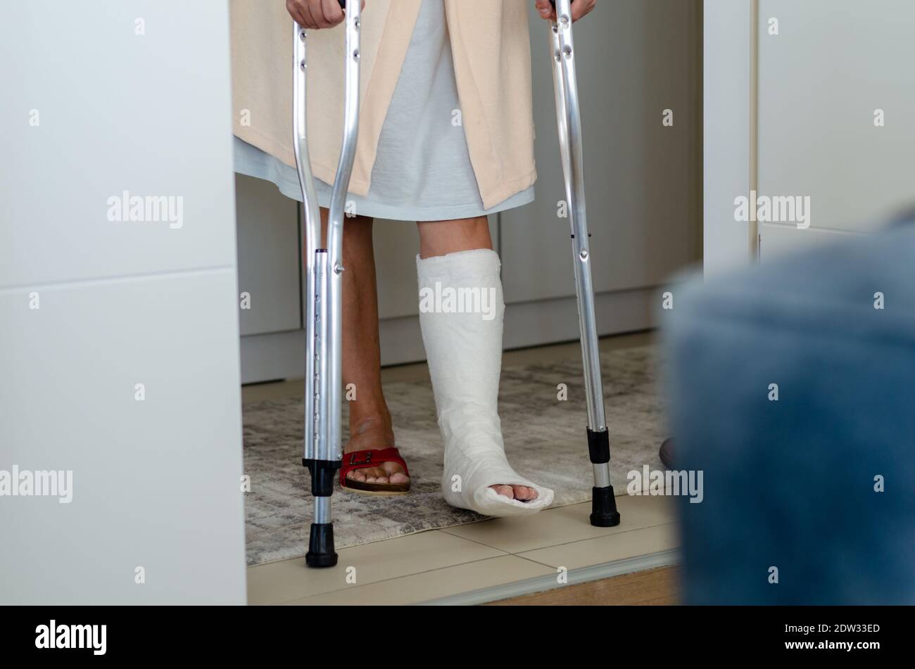 The middle aged woman with broken leg.She is standing and trying to ...