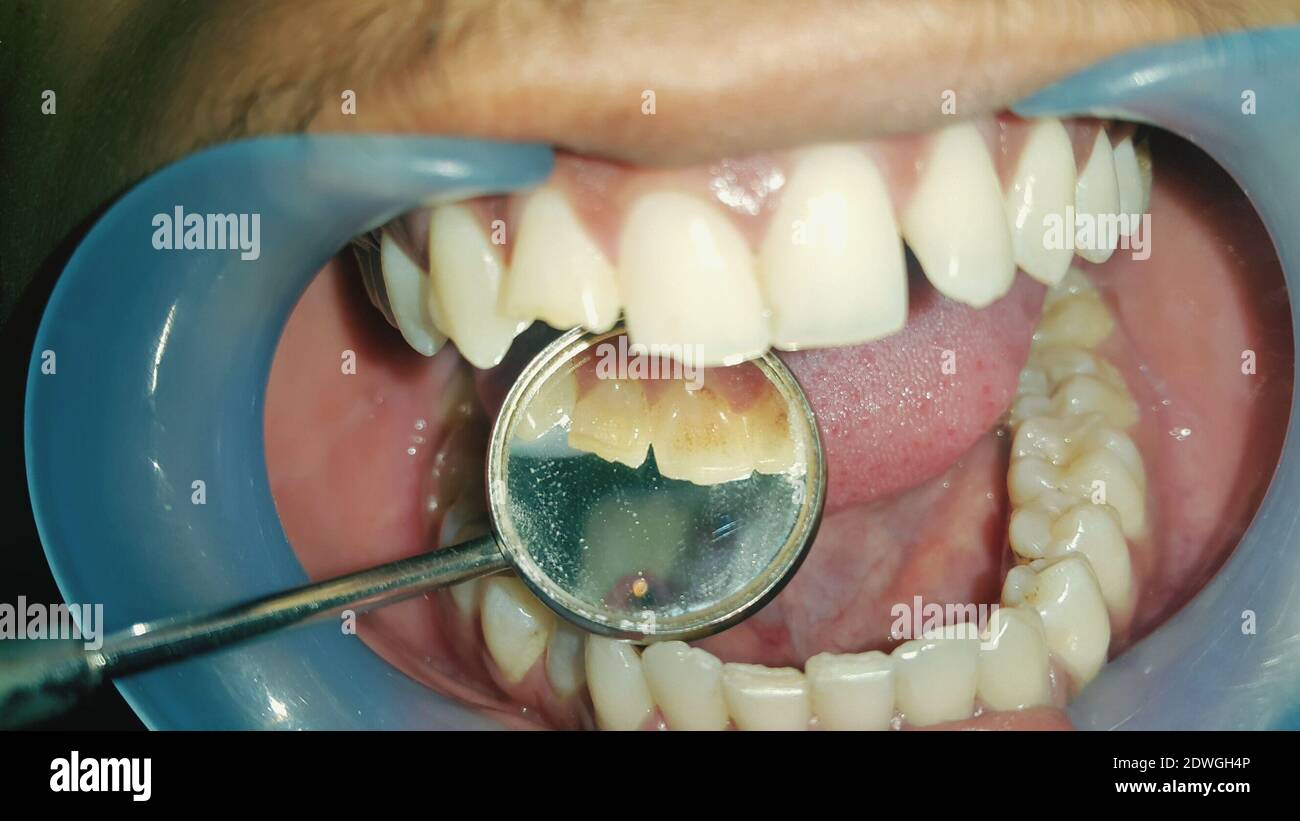 Angled body hi-res stock photography and images - Alamy