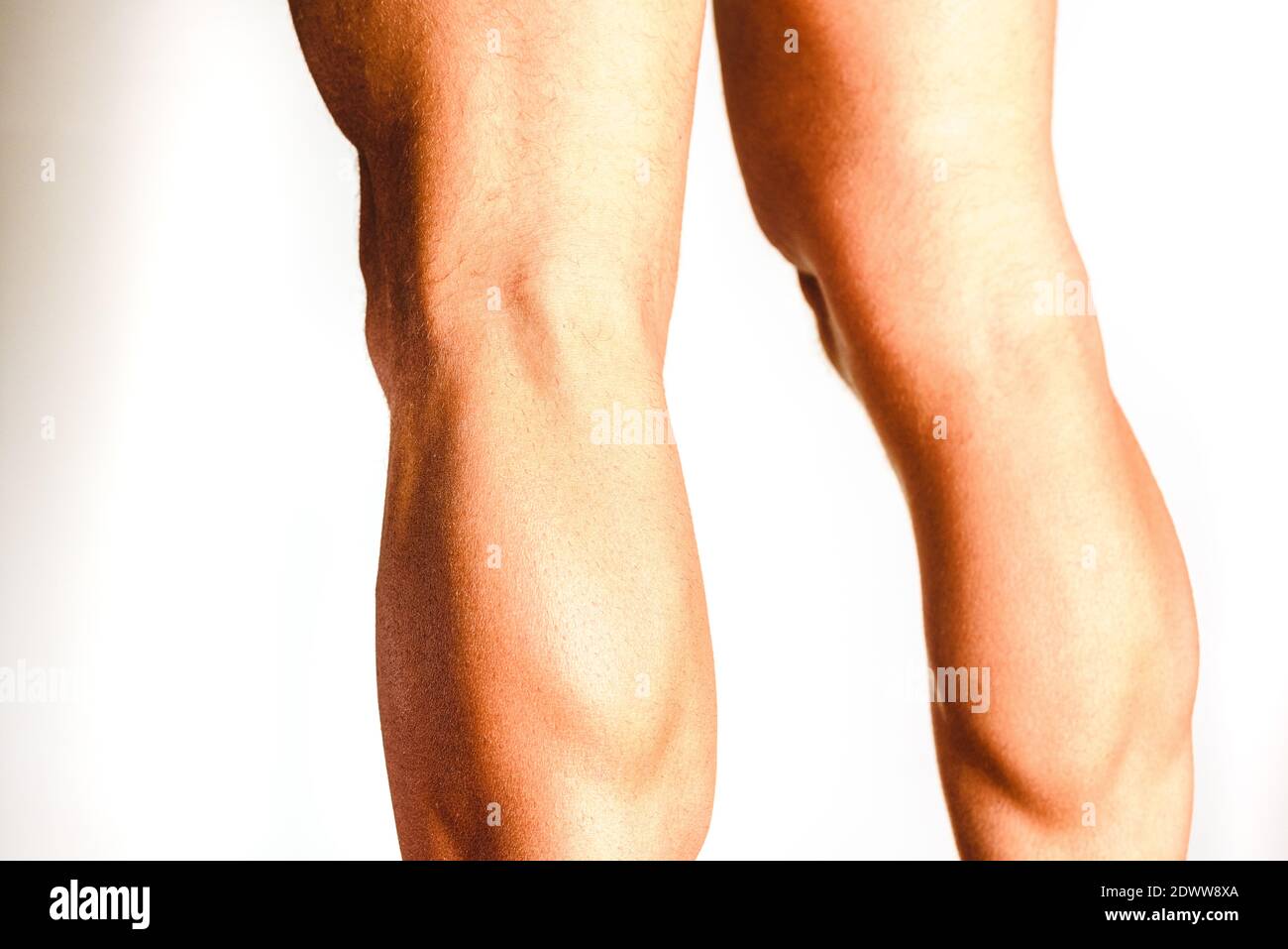 Soleus Muscle High Resolution Stock Photography and Images - Alamy