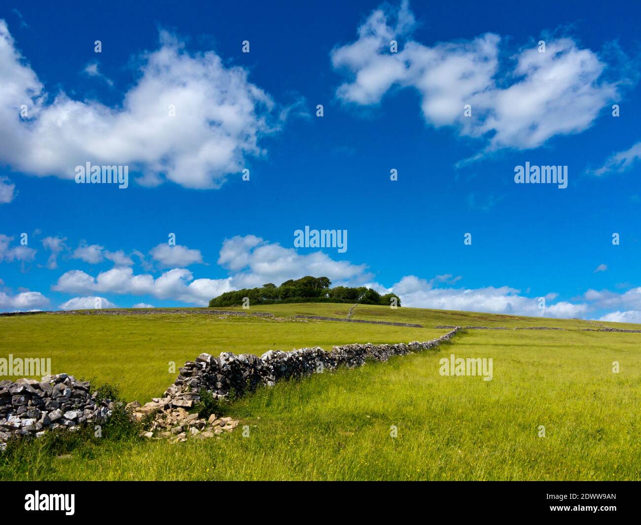 Trees at Minninglow a neolithic prehistoric burial ground near Parwich ...