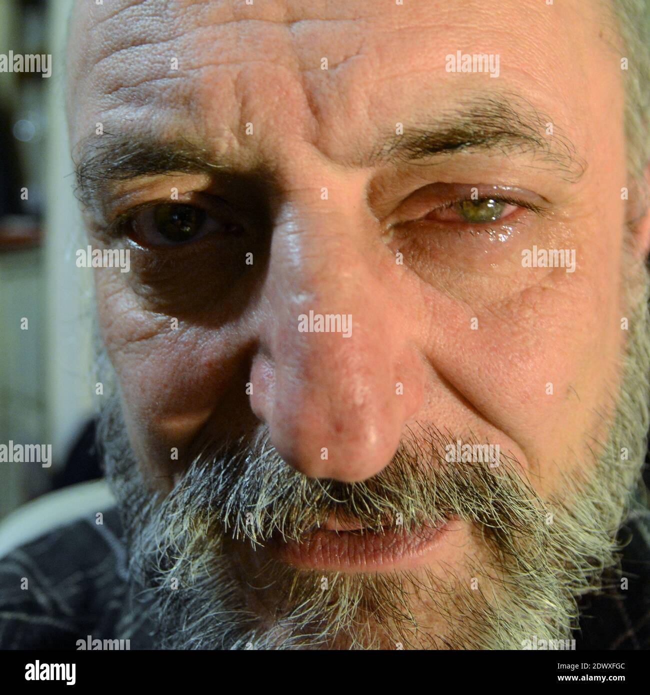 Crying eye hi-res stock photography and images - Alamy