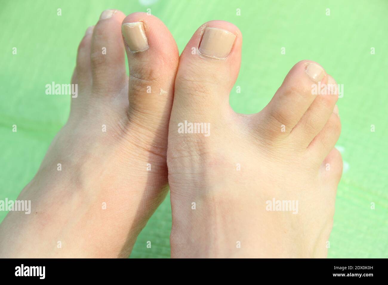 Green toenail polish hi-res stock photography and images - Alamy