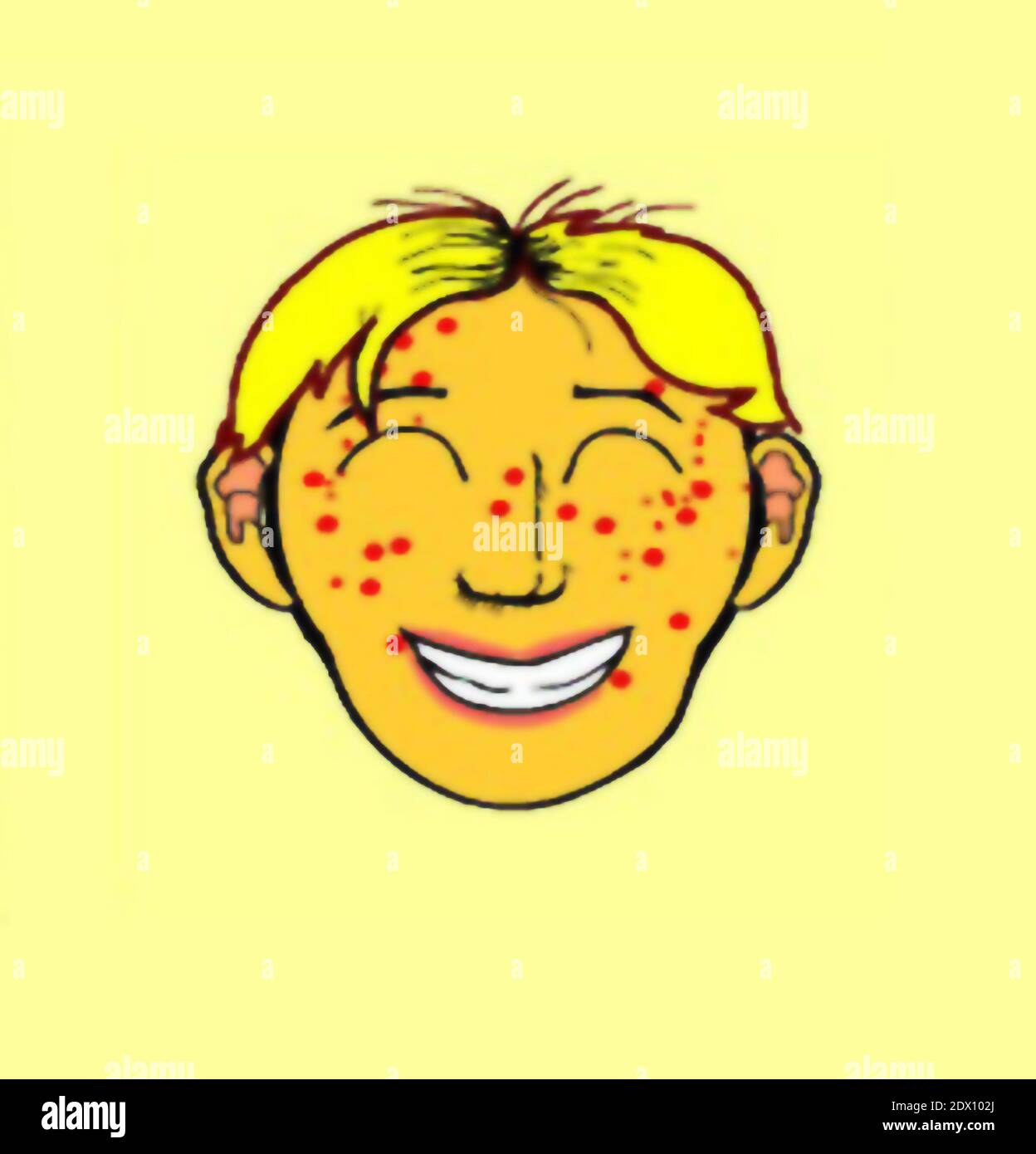 Spotty boy with blond hair cartoon face Stock Photo - Alamy