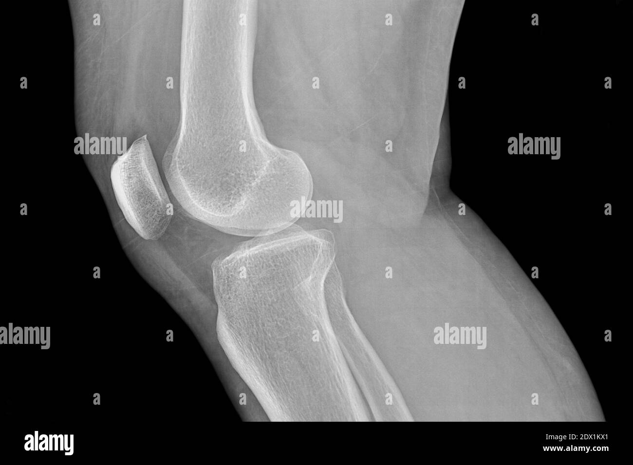 Knee Radiography of a hospital patient Stock Photo - Alamy