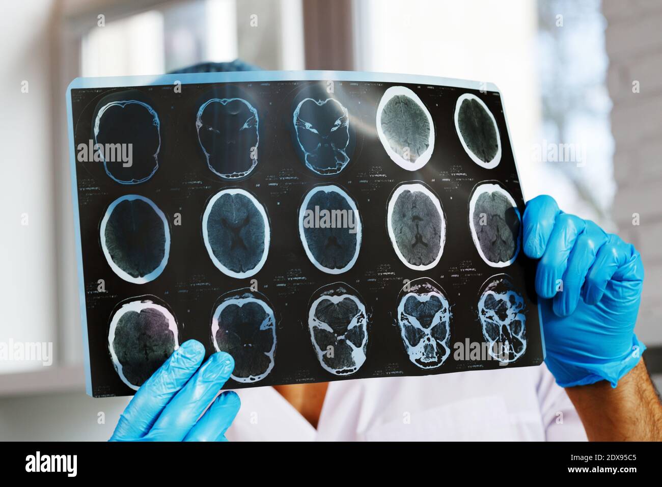 Mri scans doctor hi-res stock photography and images - Alamy