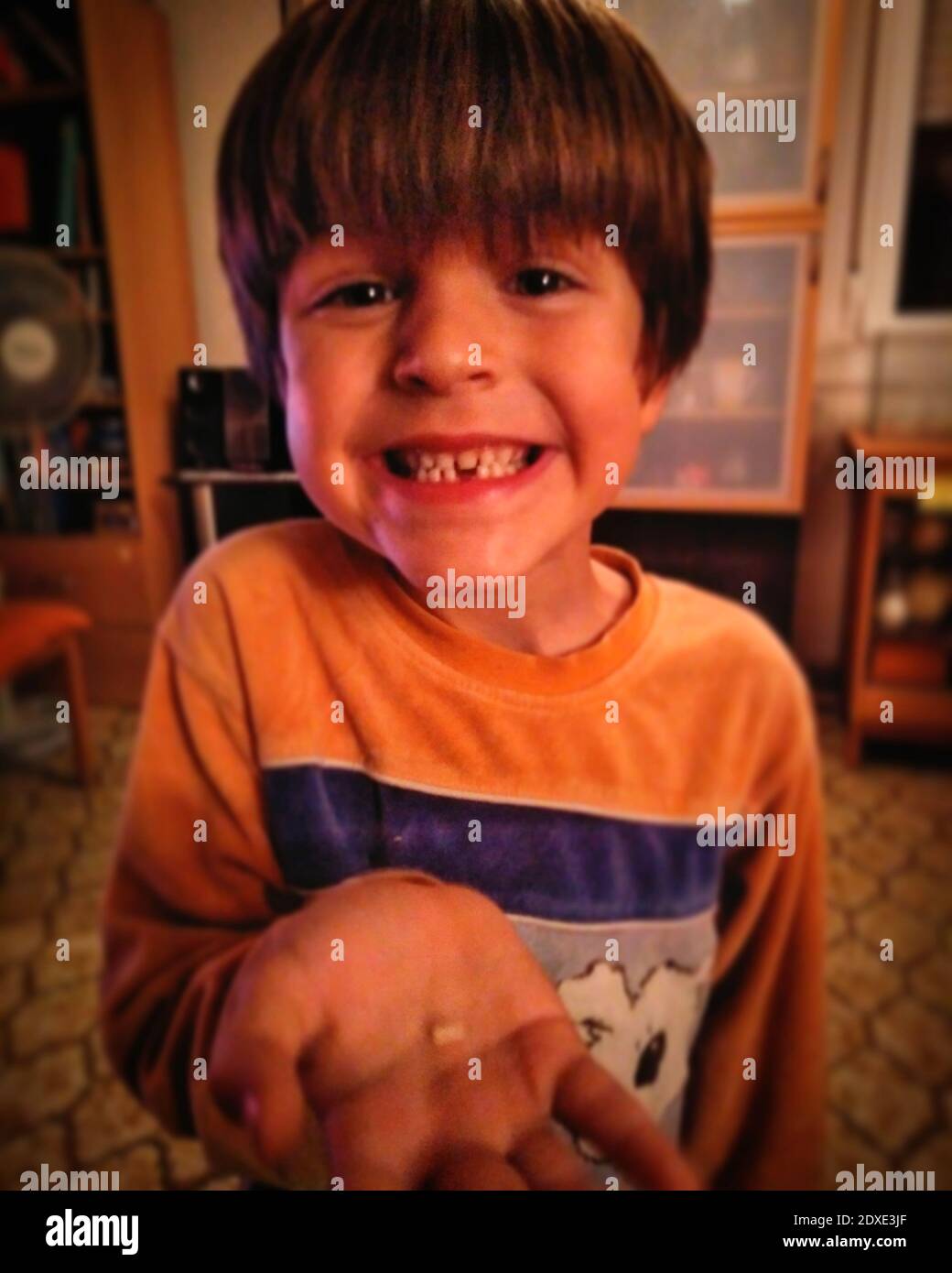 Boy broken teeth hi-res stock photography and images - Alamy