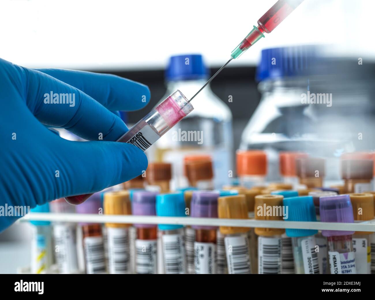Biomedical technician working with blood sample at laboratory Stock ...