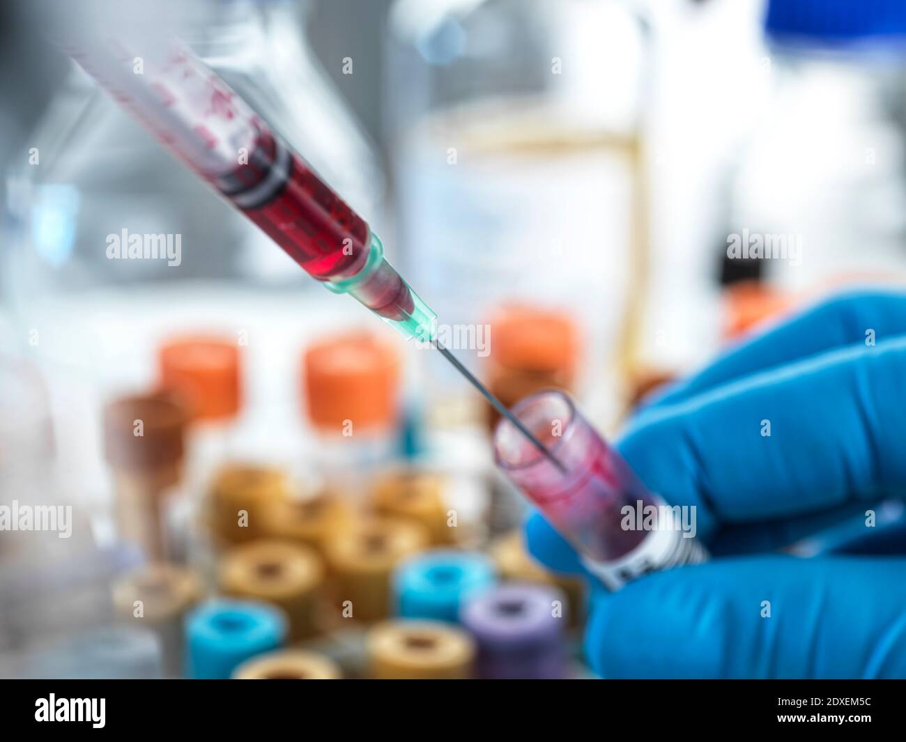 Biomedical scientist working with blood sample at laboratory Stock ...