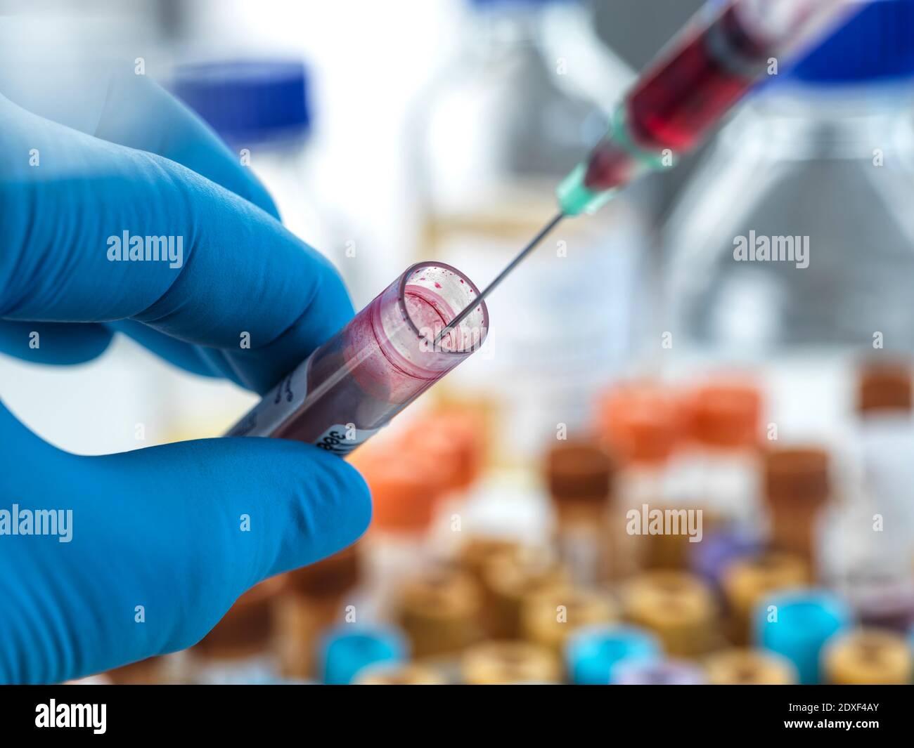 Biomedical technician testing blood sample at laboratory Stock Photo ...