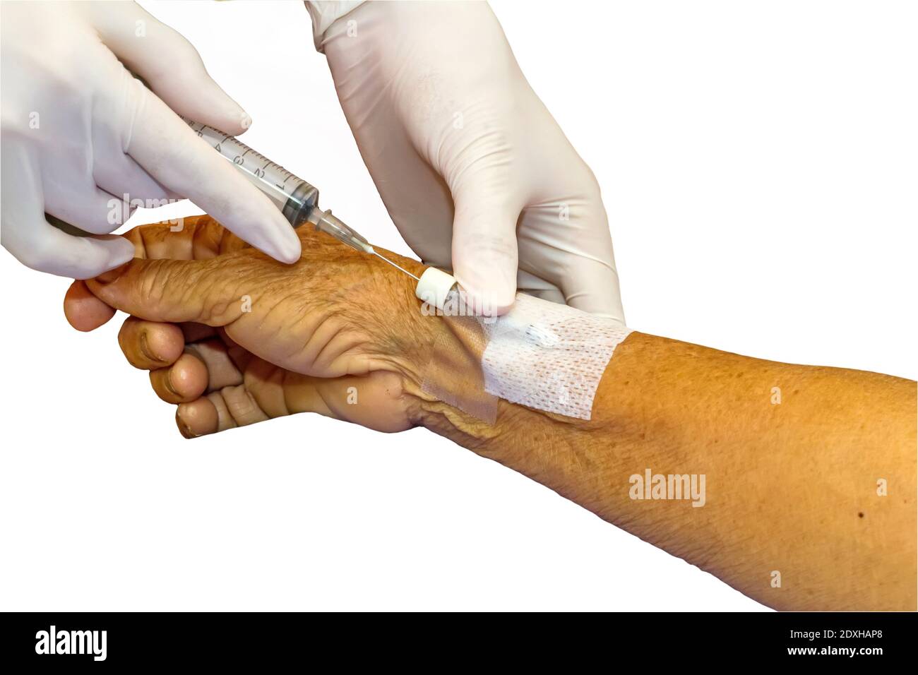 Doctor push syringe in heparin plug hand of patient Stock Photo - Alamy