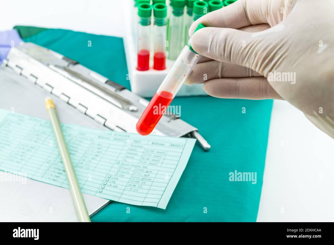 Hand with latex glove holding blood sample vial in front of blood test ...