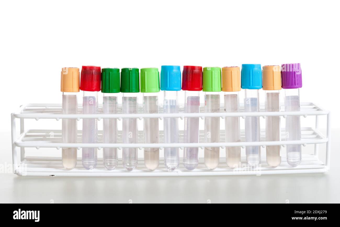 Blood collection test tubes hi-res stock photography and images - Alamy