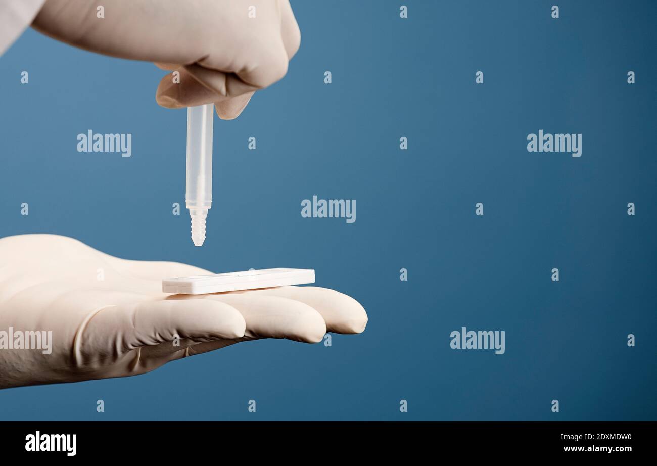 Laboratory Scientist Performing RDT Rapid Diagnostic Test For ...