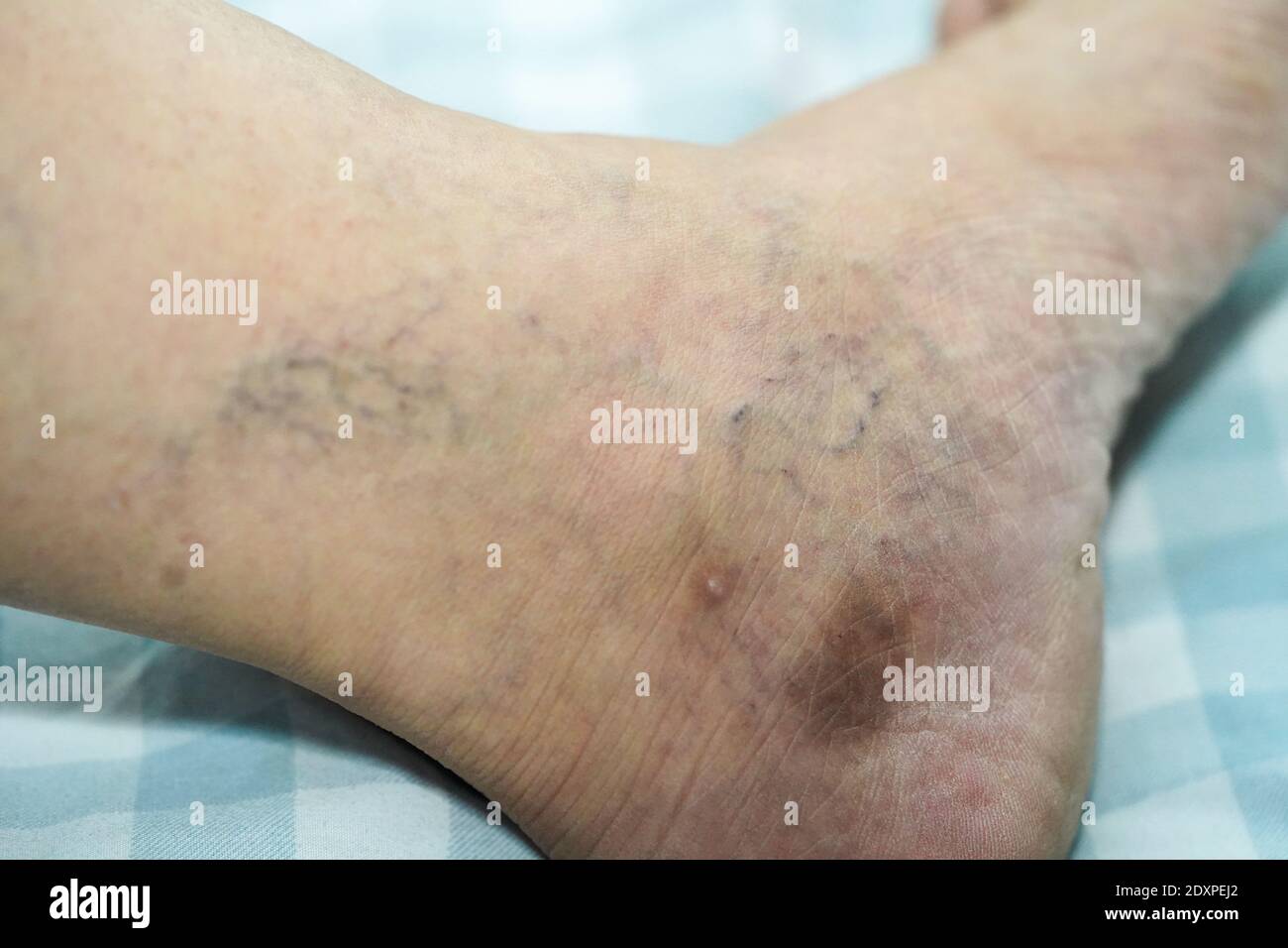 Human Leg Close Up Skin High Resolution Stock Photography and Images ...