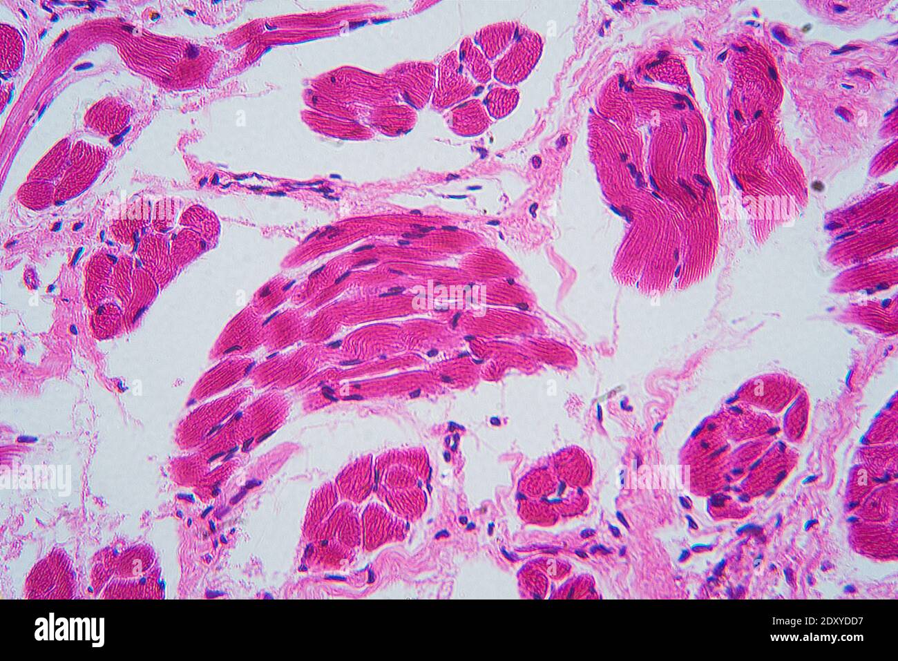 Tongue tissue hi-res stock photography and images - Alamy