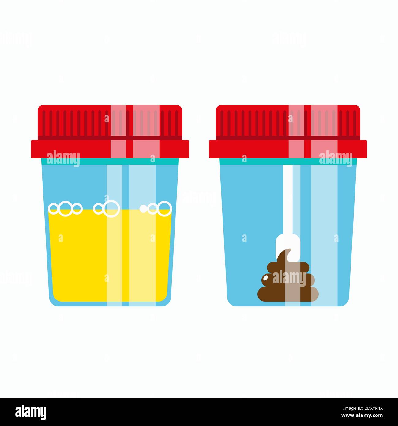 Urine and fecal analysis in plastic jars with colored lids. Laboratory ...
