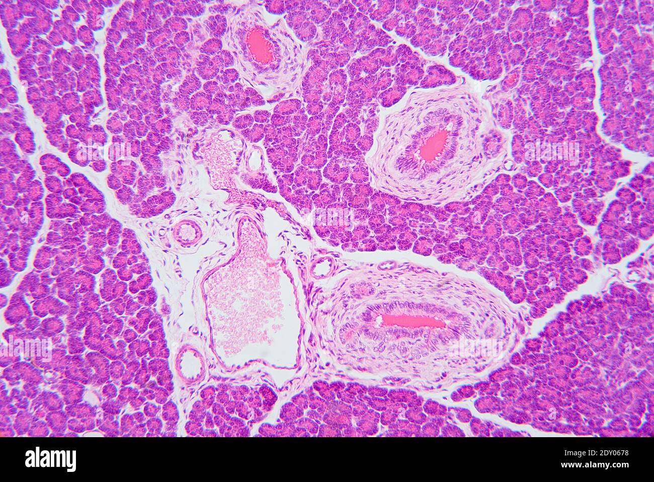 Pancreas cell micrograph hi-res stock photography and images - Alamy