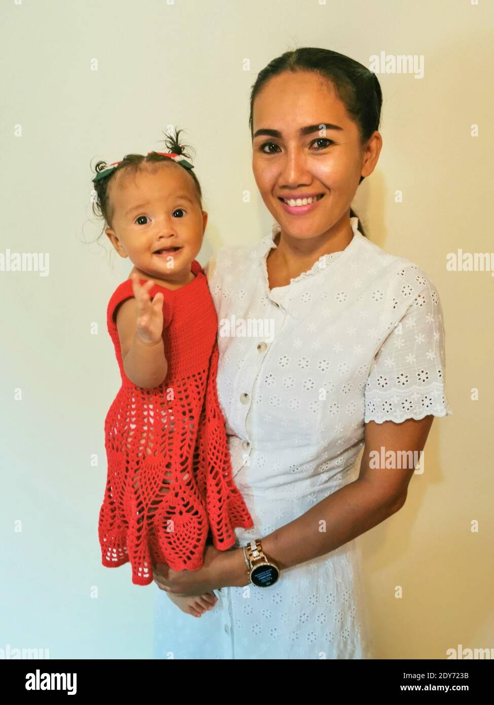 German Baby Born With Muscles