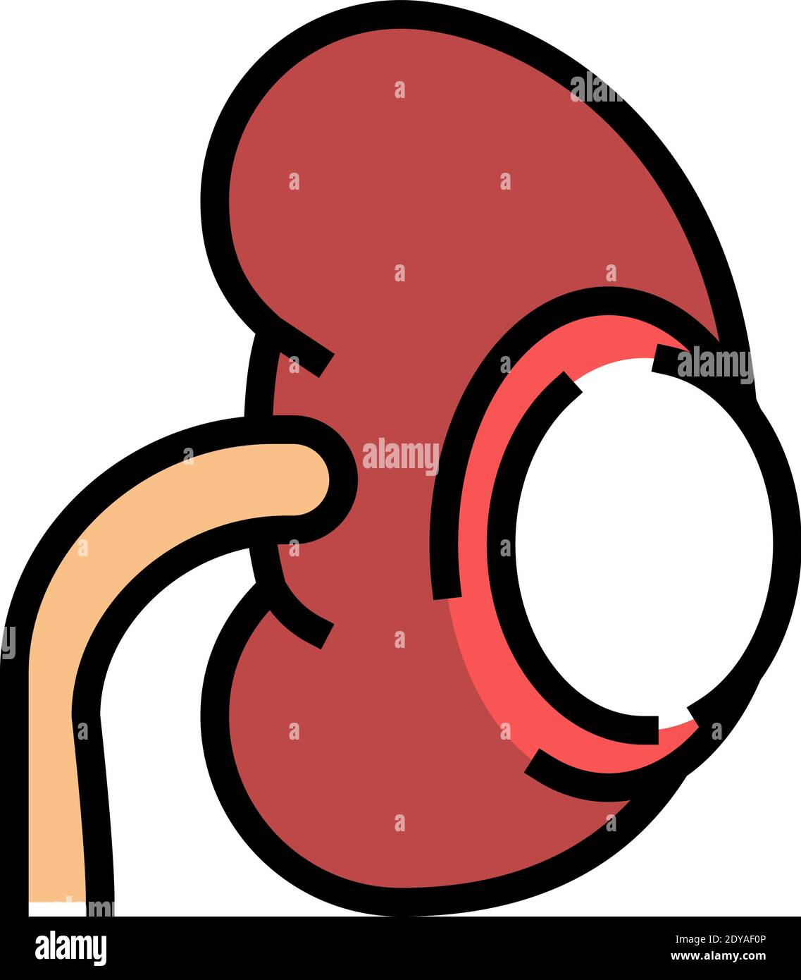 renal cyst color icon vector illustration Stock Vector Image & Art - Alamy