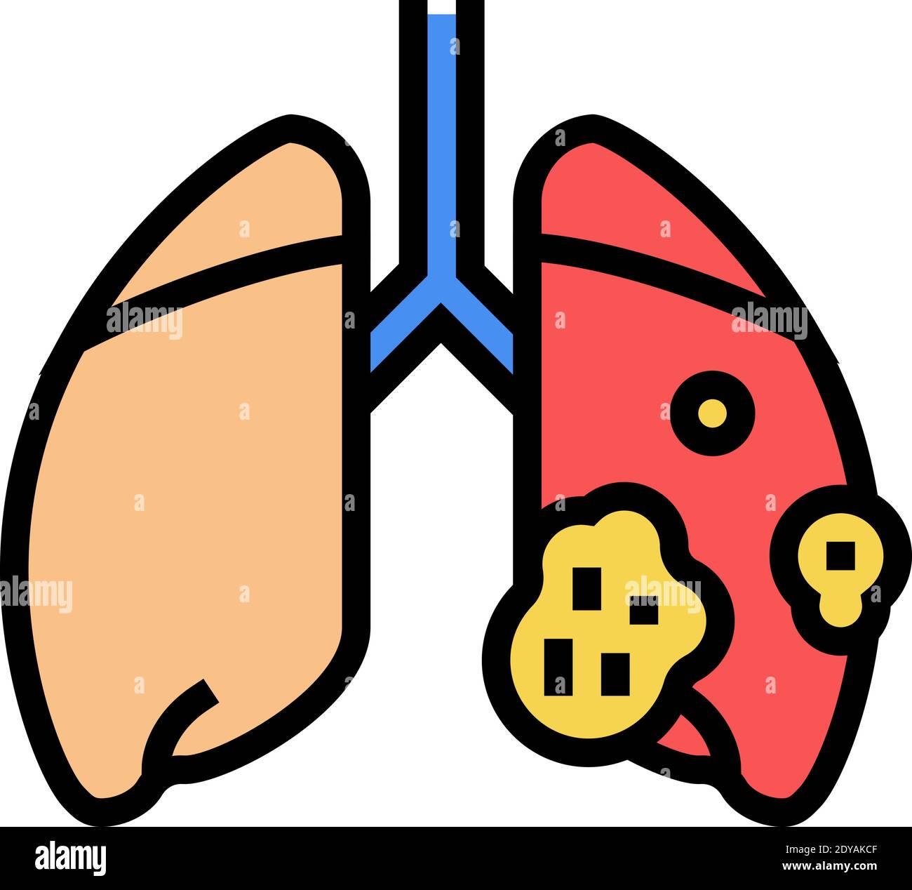 acute respiratory distress syndrome color icon vector illustration ...