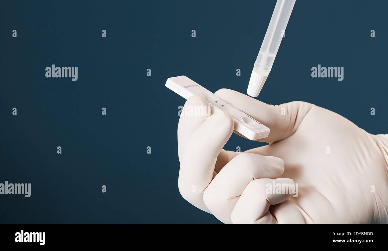 COVID-19 virus disease test, coronavirus crisis, global pandemic ...