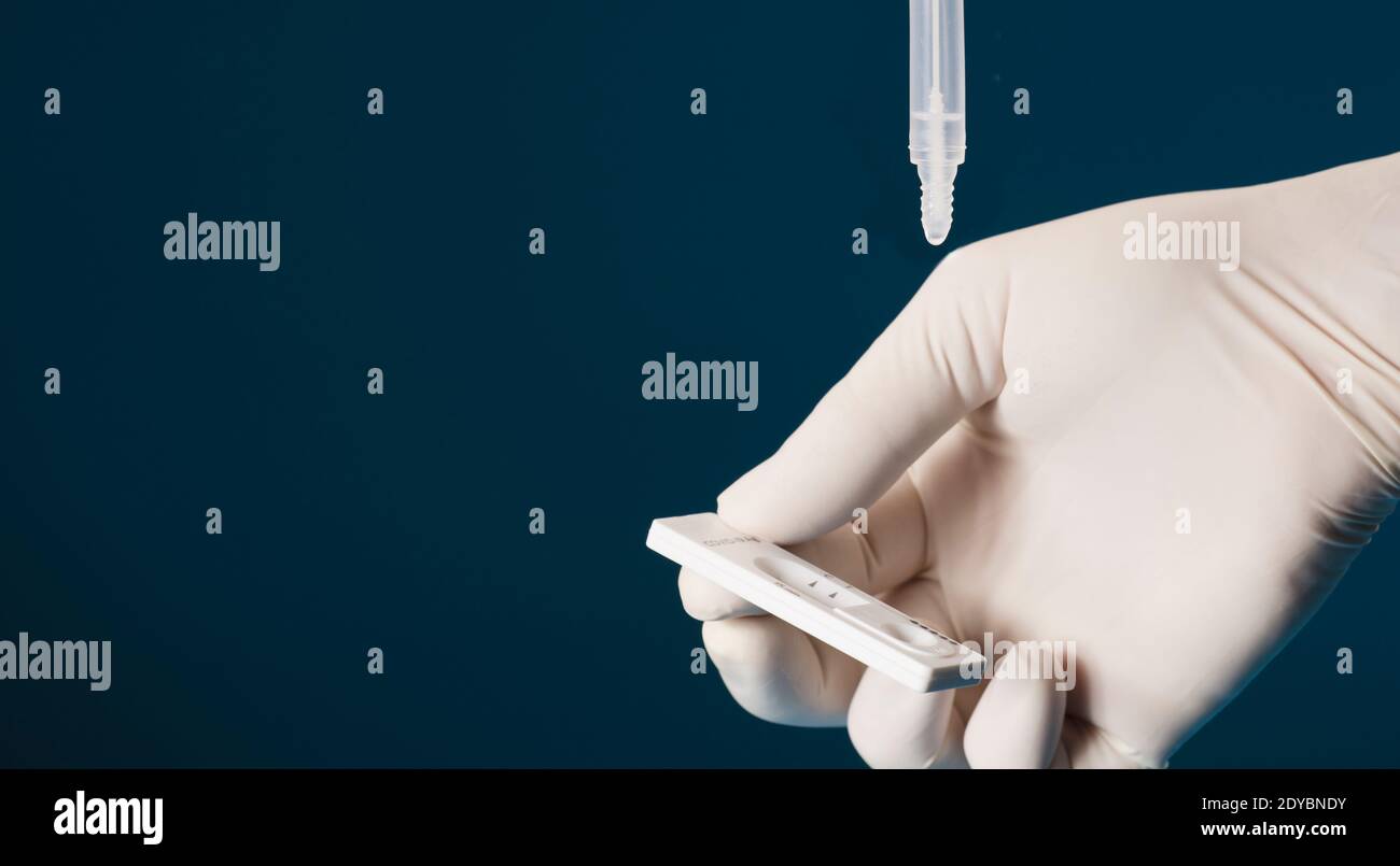 COVID-19 virus disease test, coronavirus crisis, global pandemic ...