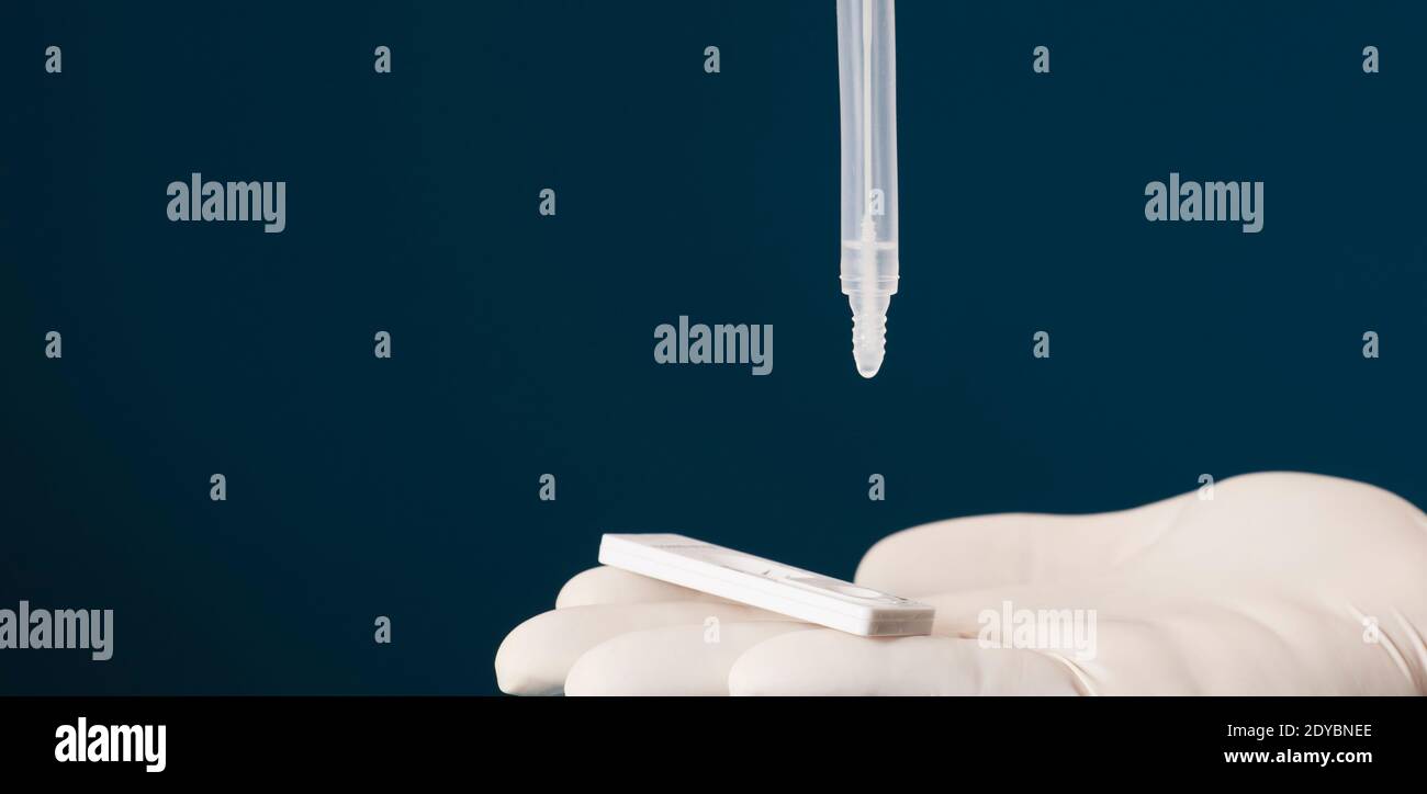 COVID-19 virus disease test, coronavirus crisis, global pandemic ...