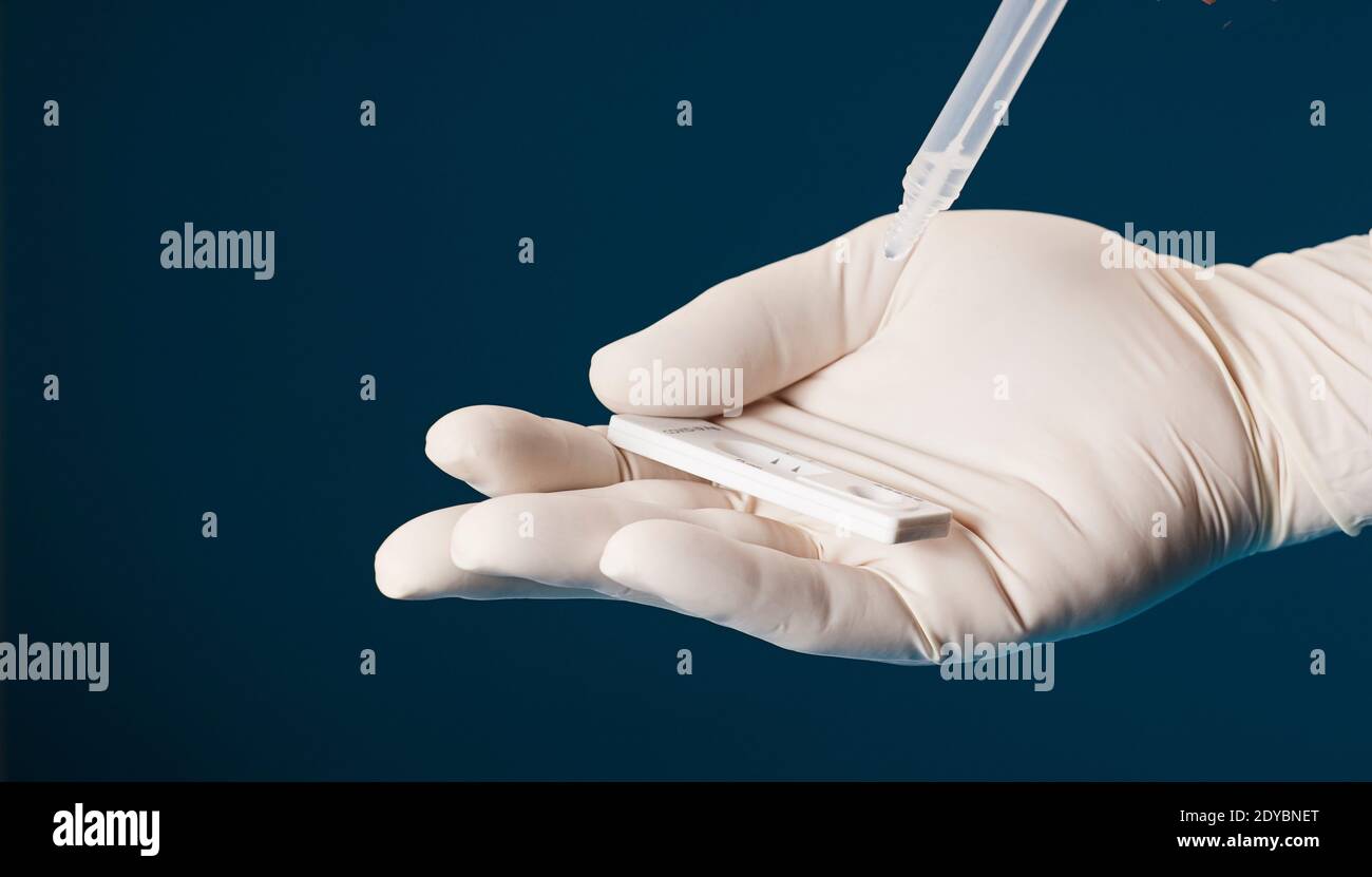 COVID-19 virus disease test, coronavirus crisis, global pandemic ...