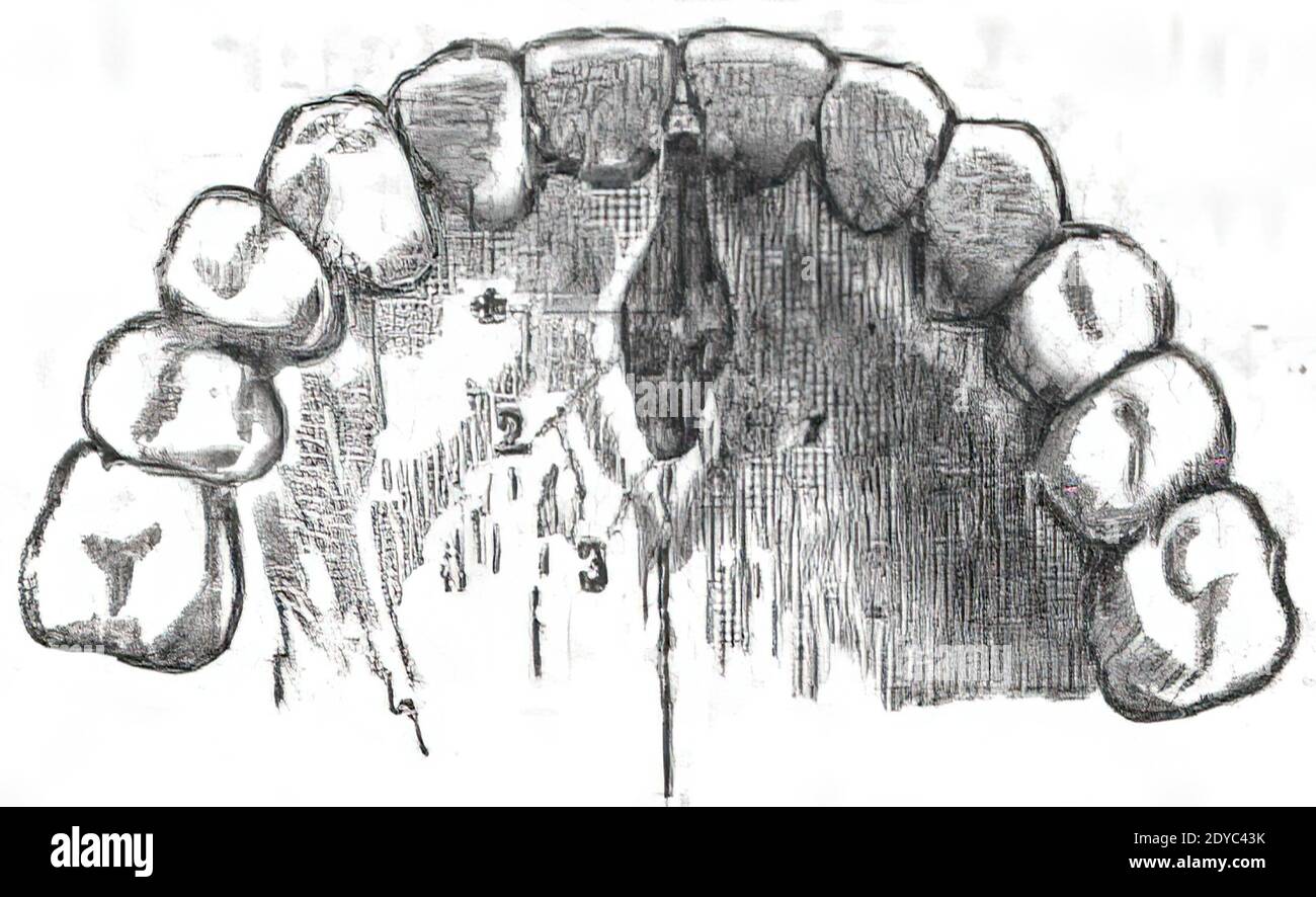 An illustration of the structure of human teeth isolated on a white ...